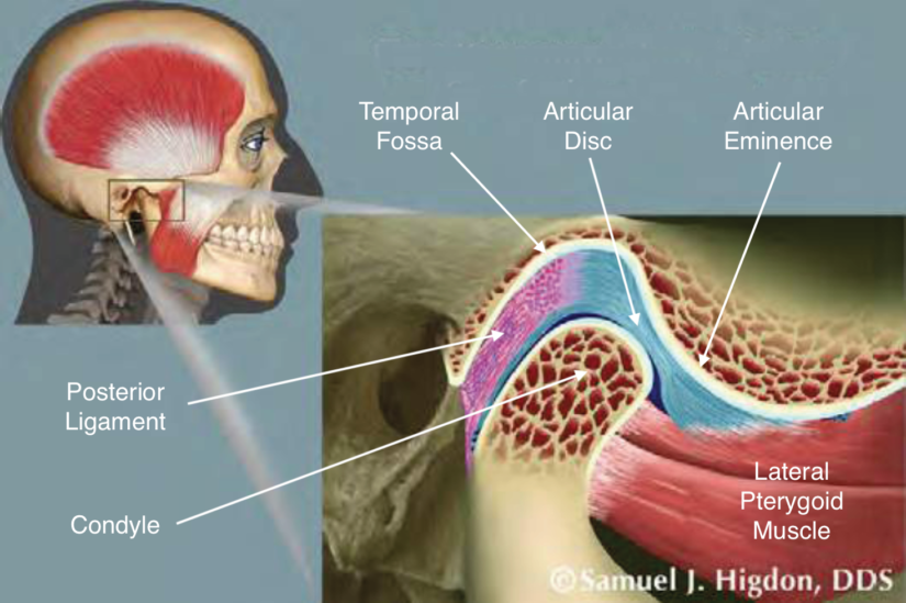 What Causes TMD? | Mountains TMJ & Dental Sleep Medicine